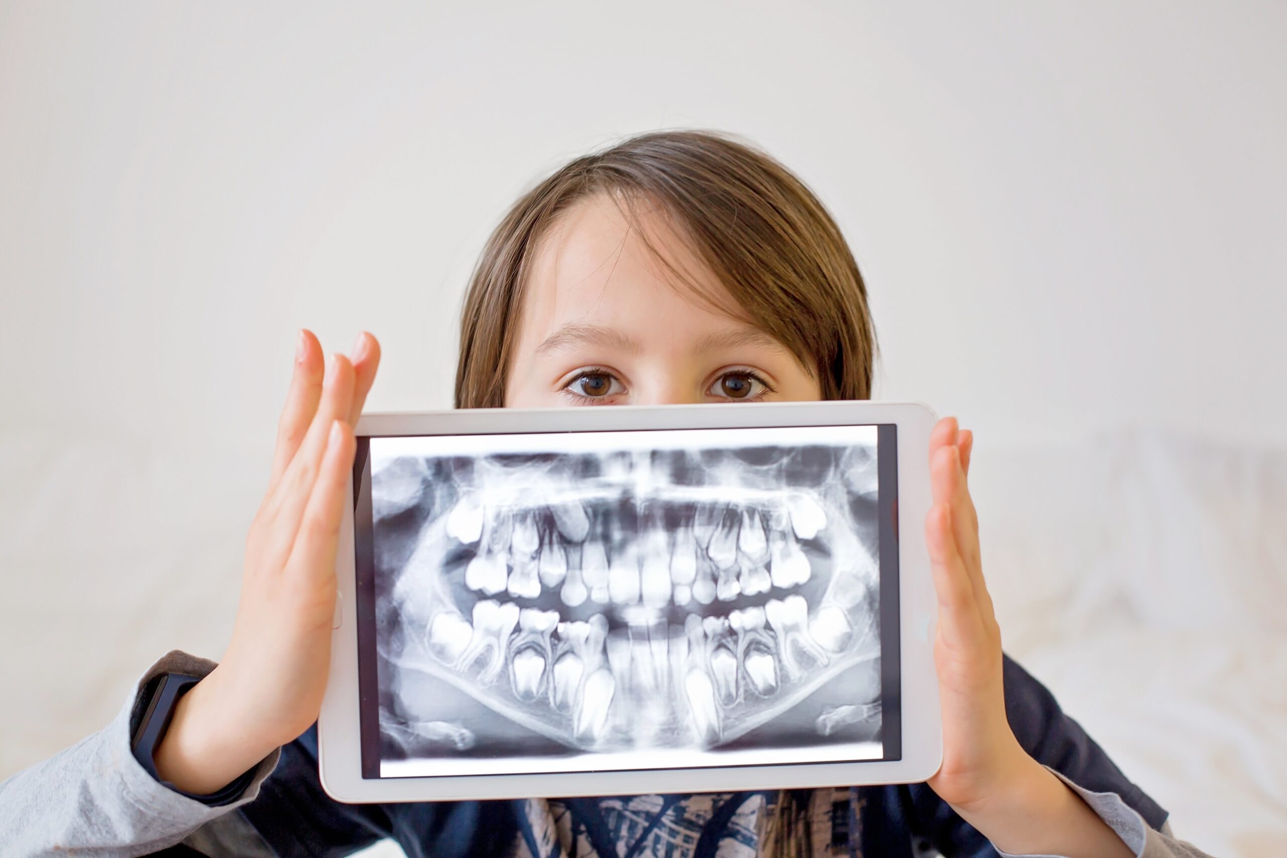How Often Should Kids Get Dental X-Rays? - Lindner Dental Associates, PC